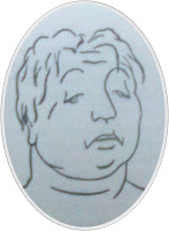 Temperamento flemático